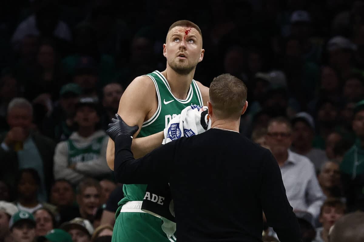 NBA: Celtics' Kristaps Porzingis hit in head, gushes blood